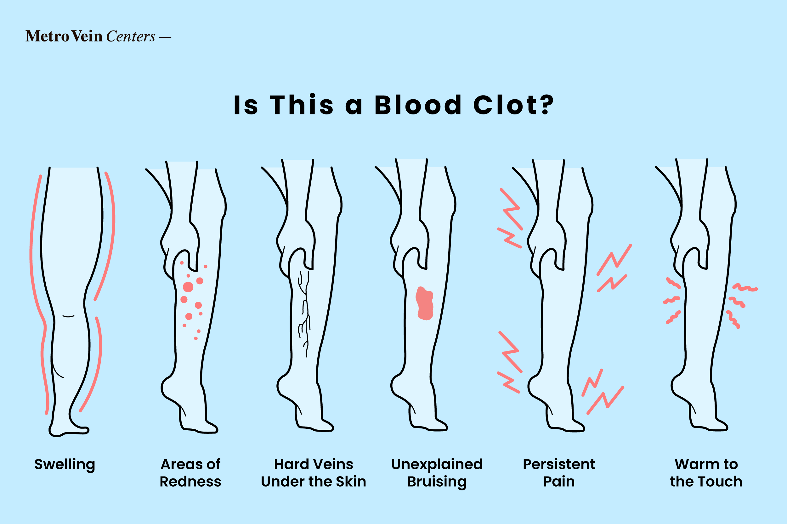 Blood Clots In The Ankles Feet And Legs Metro Vein Centers Blood Clots In The Ankles Feet And Legs Metro Vein Centers