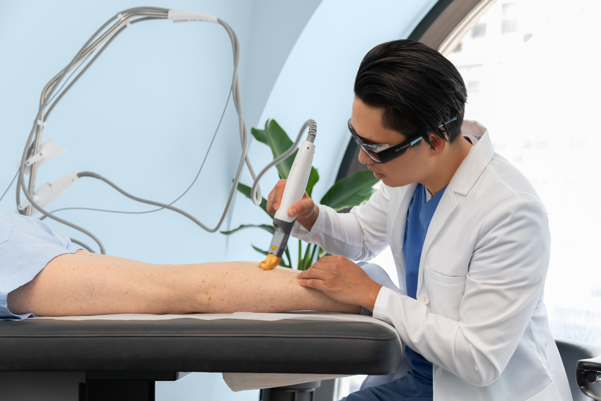 How to Treat Foot and Ankle Spider Veins | Metro Vein Centers