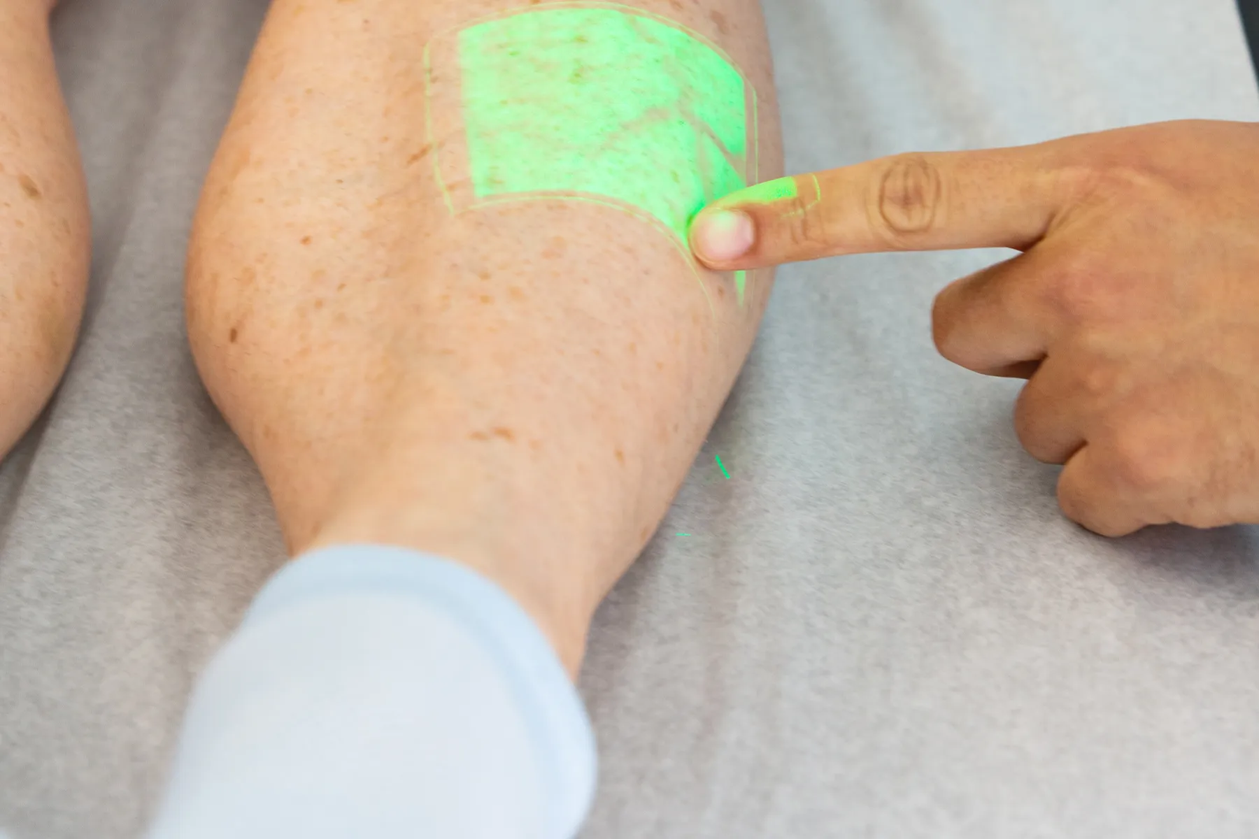 Recognizing Post-Treatment Complications | Metro Vein Centers