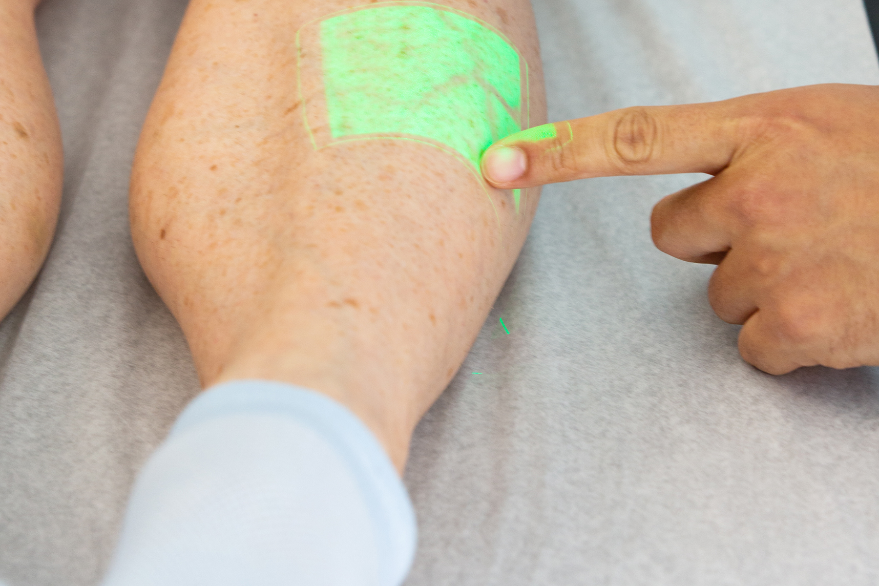 Recognizing Post-Treatment Complications | Metro Vein Centers