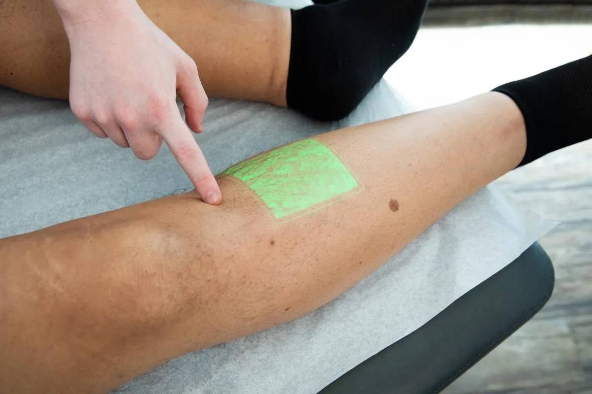 What Your Blue, Green, or Purple Veins Are Telling You | Metro Vein Centers